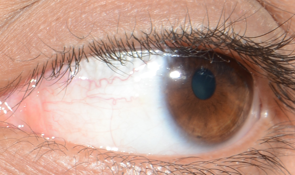 Sclera Recognition | Smart Identity Recognition Sclera Recognition | Smart Identity Recognition